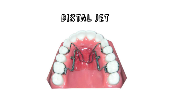Distal Jet by liliana oliveira on Prezi