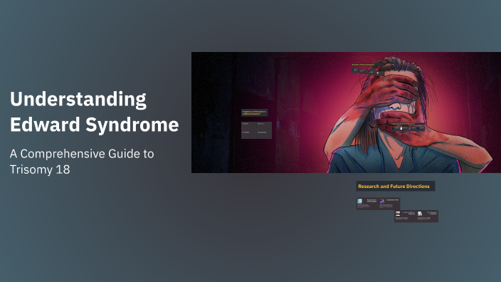Understanding Edward Syndrome by Hama Shwan on Prezi