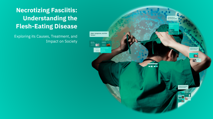 Necrotizing Fasciitis: Understanding the Flesh-Eating Disease by Giada ...