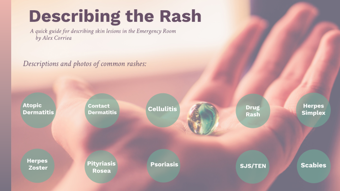 Describing the Rash by Alexanra Corriea on Prezi