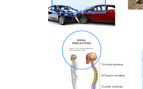 SPINAL PRECAUTIONS by Doug Page on Prezi