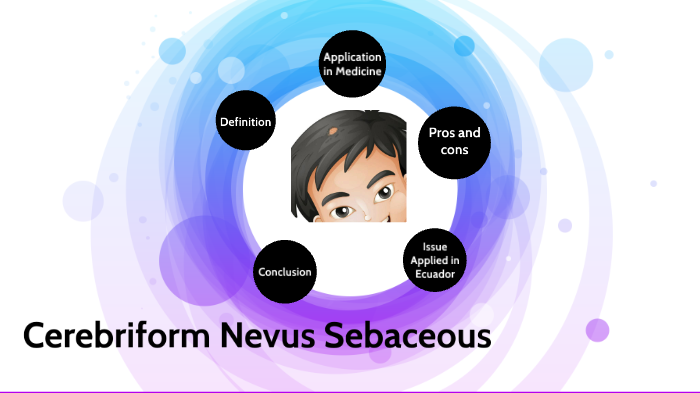 Cerebriform Nevus Sebaceous by Dayana Novillo on Prezi
