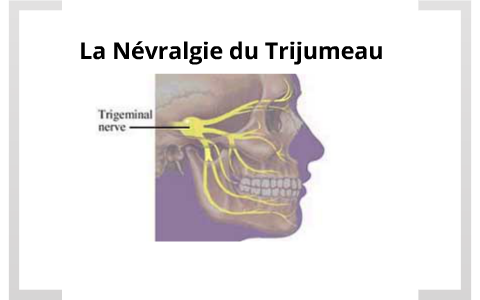 La Nevralgie du Trijumeau by Salvatore Cognetti on Prezi