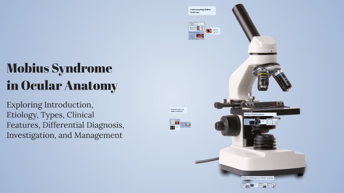 Mobius Syndrome in Ocular Anatomy by prakash sharma on Prezi