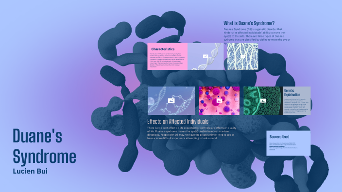 duane's syndrome by Emmie Bui on Prezi