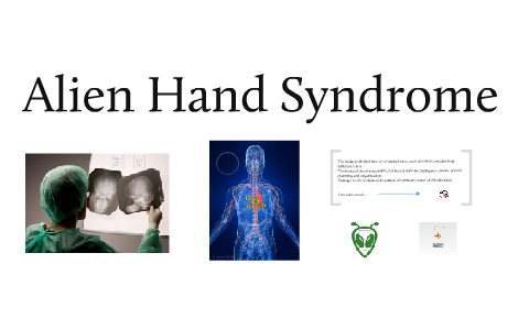 Alien Hand Syndrome by David Lyons on Prezi