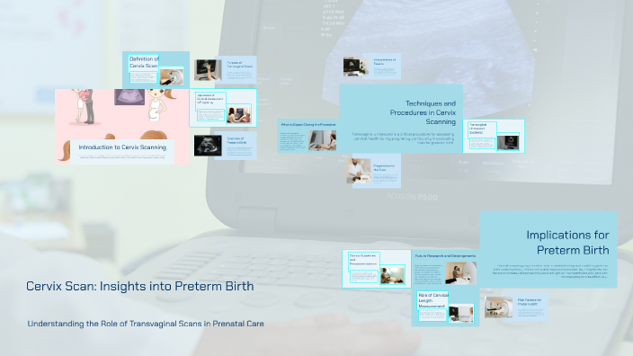 Cervix Scan: Insights into Preterm Birth by Asha gowrikanthan on Prezi
