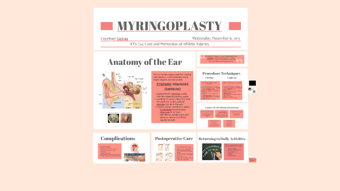 MYRINGOPLASTY by Courtney Guirao on Prezi