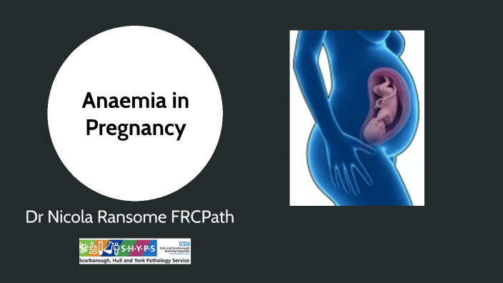 Anaemia in Pregnancy 2 by Nicola Ransome on Prezi