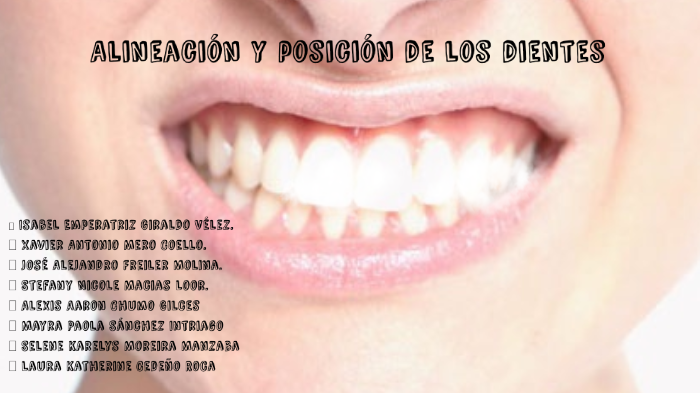 Alineación y posición de los dientes by Isabel Giraldo on Prezi