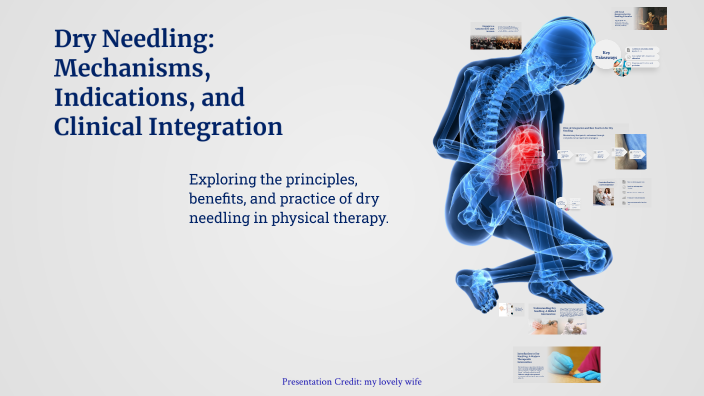 Dry Needling: Mechanisms, Indications, and Clinical Integration by ...