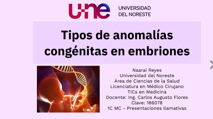 Tipos de anomalías congénitas en embriones by NAARAI ABIGAHIL REYES ...