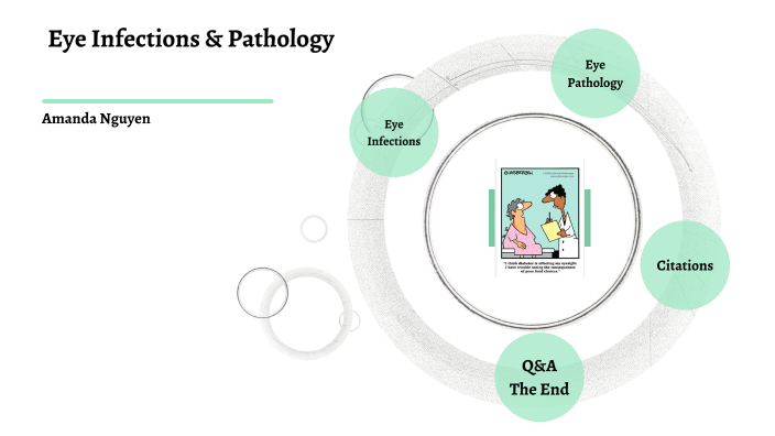 Eye Infections & Pathology by Amanda Nguyen on Prezi