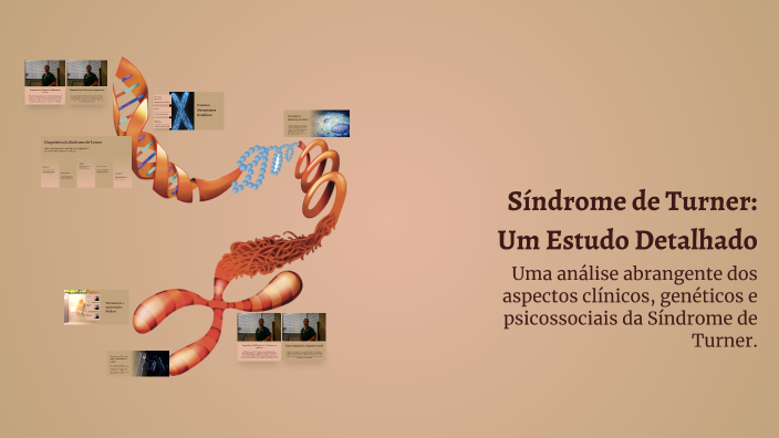Síndrome de Turner: Um Estudo Detalhado by Beatriz Aquino Bezerra on Prezi