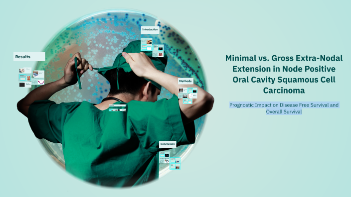 Minimal vs. Gross Extra-Nodal Extension in Node Positive Oral Cavity ...