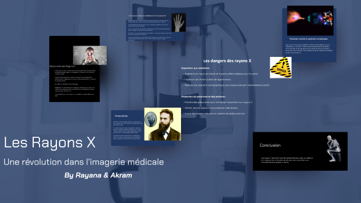 Les Rayons X by rayana zelimchanov on Prezi