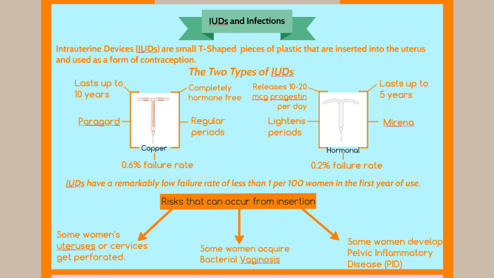 IUDs and Infections: Infographic by Alan Ha on Prezi