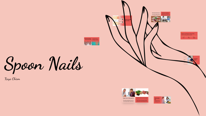 Understanding Spoon Nails: Causes, Symptoms, and Treatments by Xaya ...