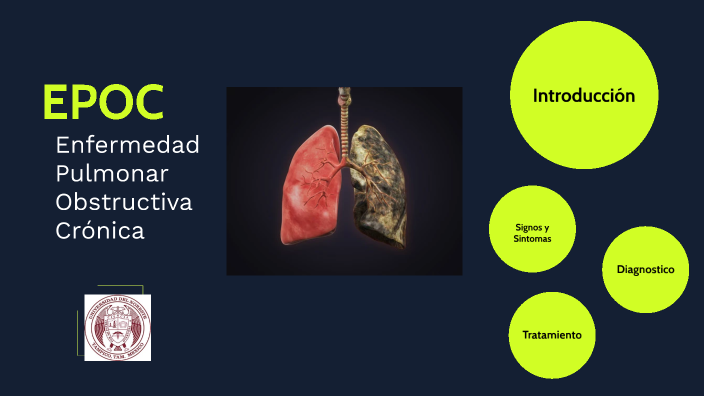 EPOC by HECTOR NOE SILVA MARTINEZ on Prezi