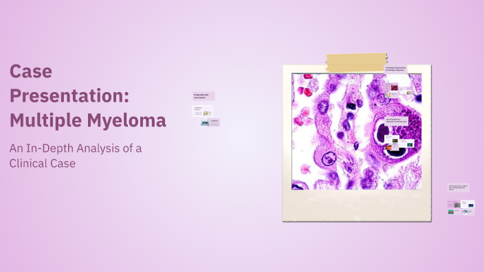Case Presentation: Multiple Myeloma by on Prezi