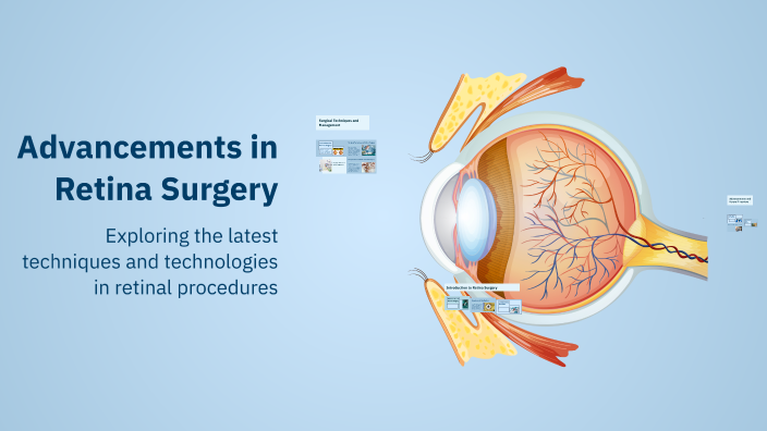 Advancements in Retina Surgery by Saba Samet on Prezi