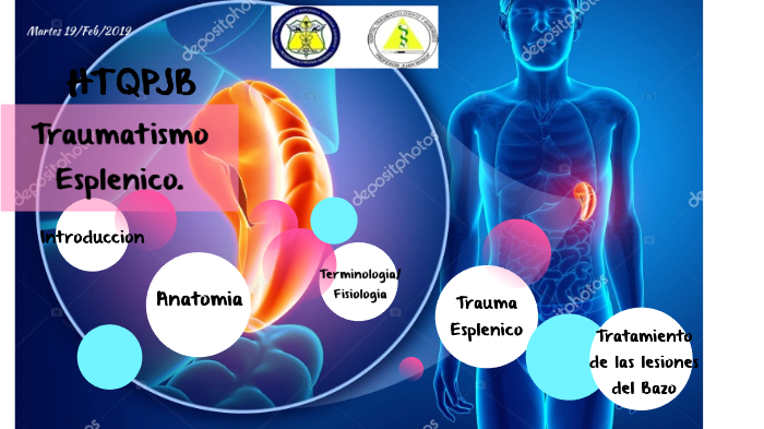 trauma esplenico by melissa rodriguez on Prezi