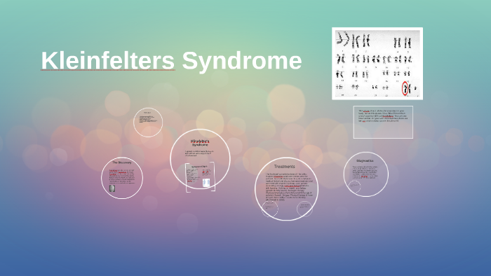 Kleinfelters Syndrome by Kendra W on Prezi