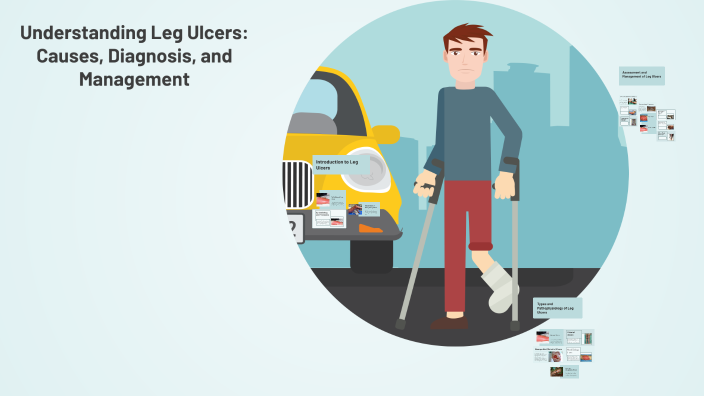 Understanding Leg Ulcers: Causes, Diagnosis, and Management by Harriet ...