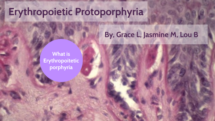 Erythropoietic Protoporphyria by Jasmine Merritt on Prezi