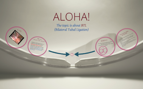 (BTL) Bilateral Tubal Ligation by Tasja Natividad on Prezi