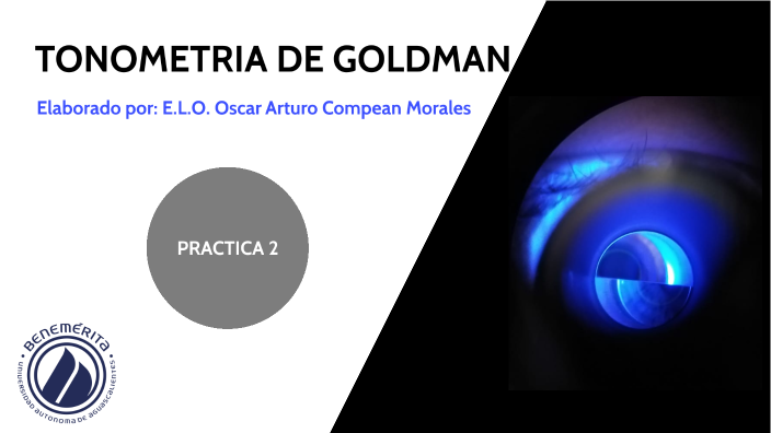 TONOMETRIA DE GOLDMAN by Oscar Compean on Prezi