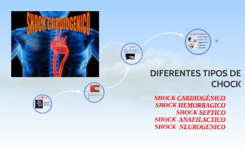 DIFERENTES TIPOS DE CHOCK by Mari lopez lopez on Prezi