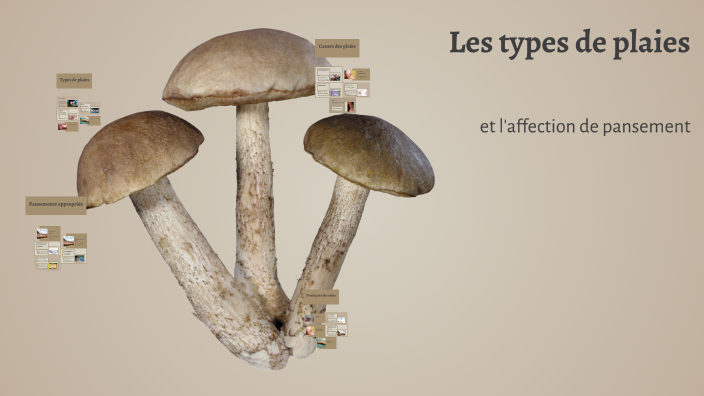 Les types de plaies by Islem Ben salem on Prezi