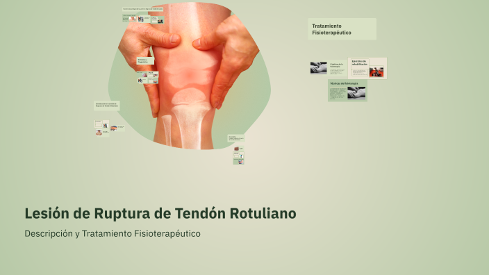 Lesión de Ruptura de Tendón Rotuliano by MIGUEL PALACIO on Prezi