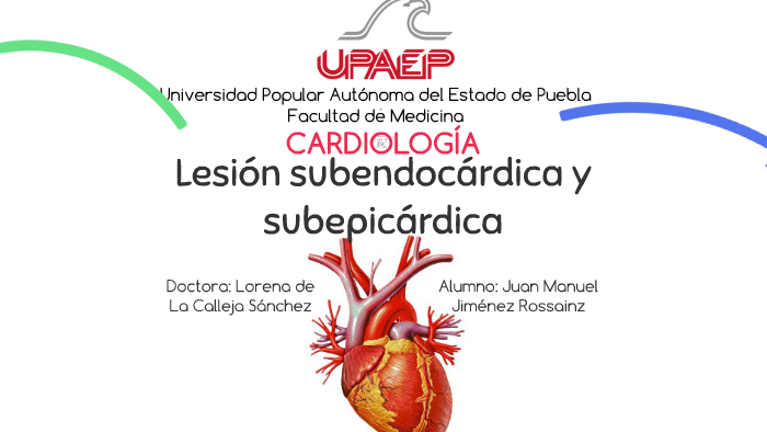 Lesión subendocárdica y subepicárdica; Infarto agudo a Miocardio by ...