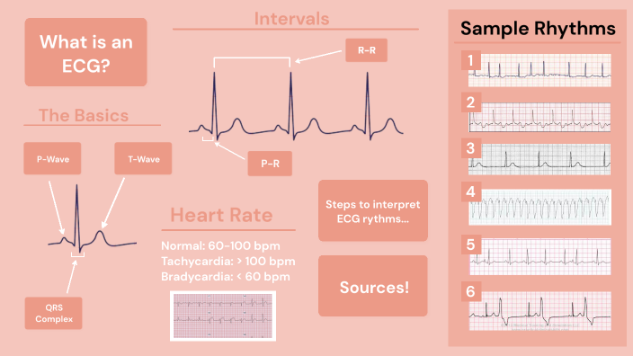 How to Read an EKG by Grace Bliesner on Prezi