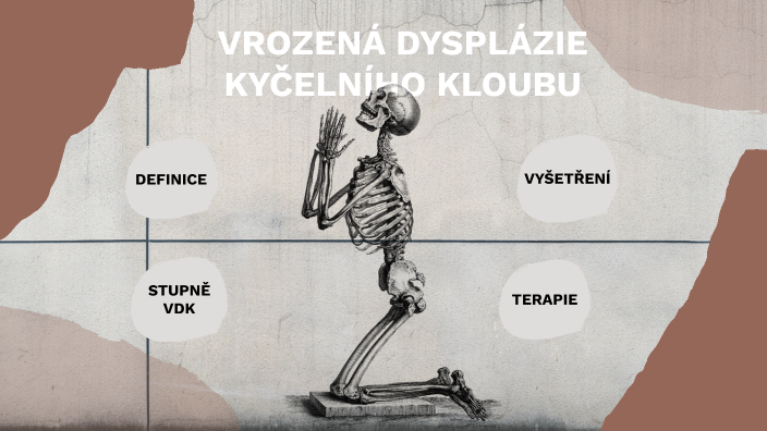Vrozená dysplazie kyčelního kloubu by Veronika Geržová on Prezi