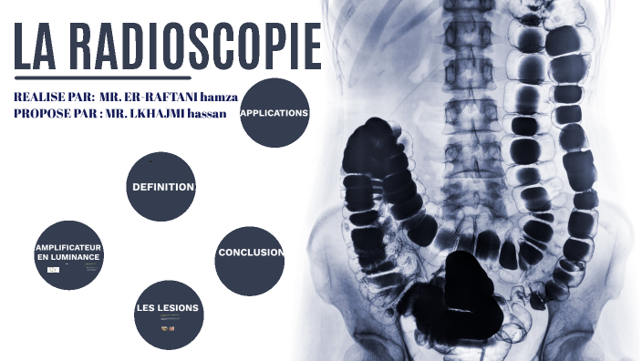 La radioscopie by asmae channane on Prezi