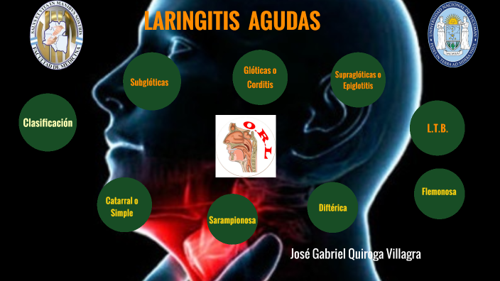 Laringitis Agudas by Gabriel Quiroga on Prezi