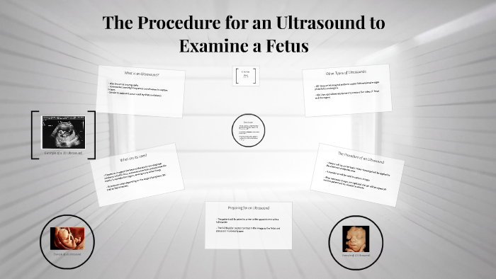 The Procedure for an Ultrasound to Examine a Fetus by Ilee Taylor on Prezi