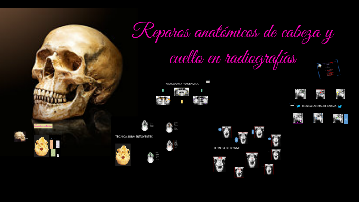 Reparos anatómicos de cabeza y cuello en radiografías by Katherine ...