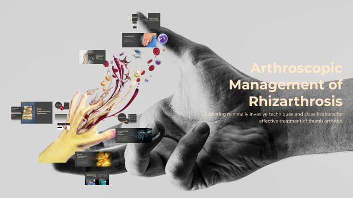 Arthroscopic Management of Rhizarthrosis by cristina merino on Prezi