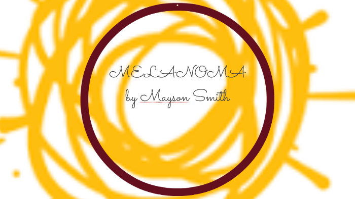 Melanoma project by mayson smith on Prezi