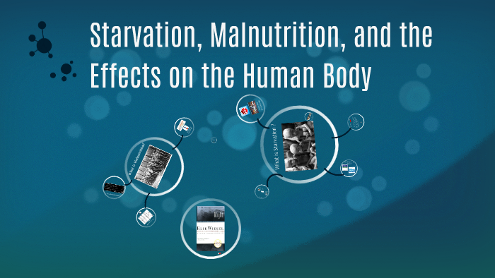 Starvation, malnutrition, and the effects on human body by Grace Weldon ...