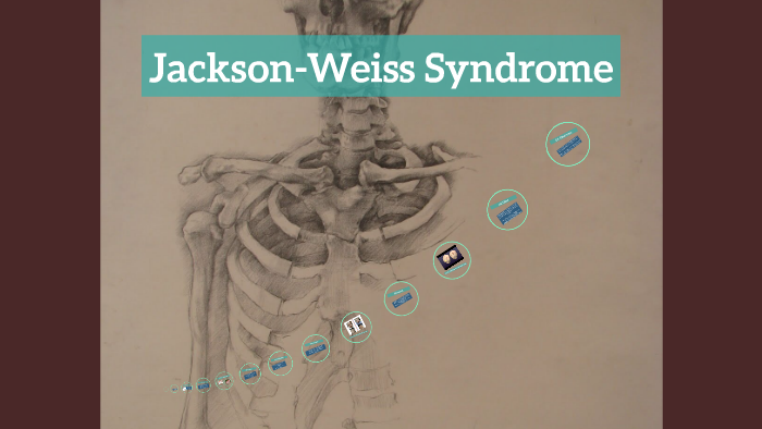 Jackson-Weiss Syndrome by Owen Kelly on Prezi
