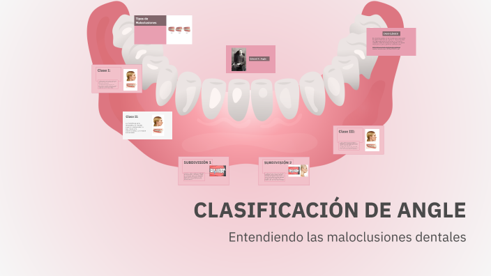 CLASIFICACIÓN DE ANGLE by Maria Baca on Prezi