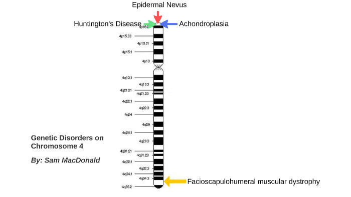 Genetic Disorders on Chromosome 4 by Sam MacDonald