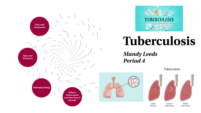 Pathophysiology Report by Amanda Leeds on Prezi