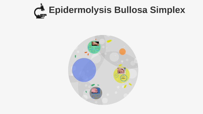 Epidermolysis Bullosa Simplex by Aria Baylor on Prezi