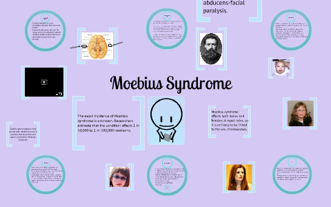 Moebius Syndrome 2 by Valerie Guerrero on Prezi